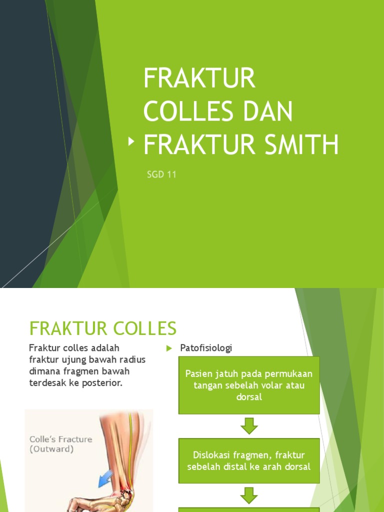 Fraktur Smith Dan Colles | PDF