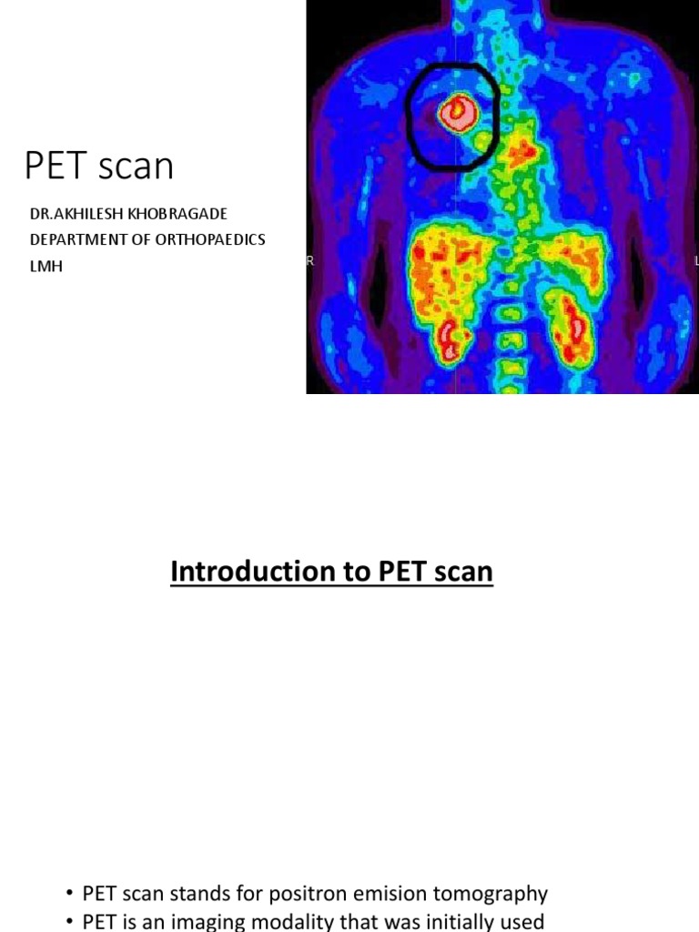 Pet Scan | PDF | Positron Emission Tomography | Radioactive Tracer
