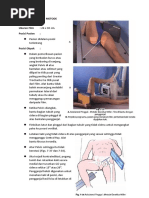 Teknik Radiografi Mandibula | PDF