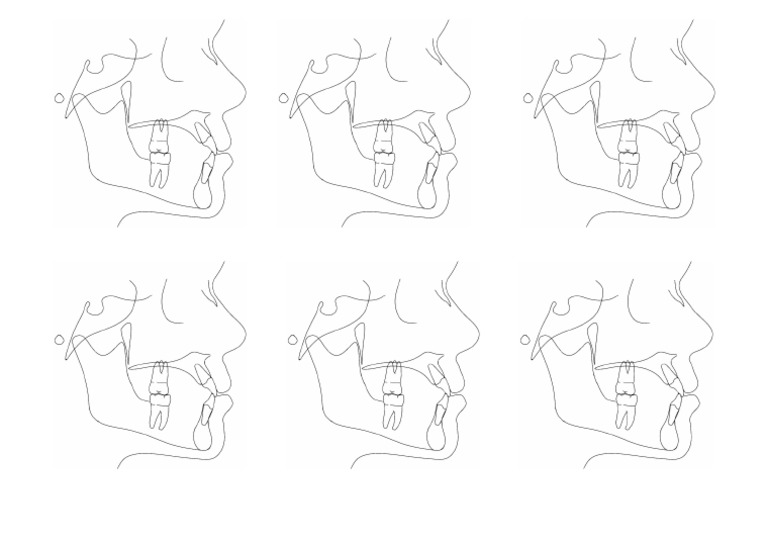 Cefalometria TRG | PDF