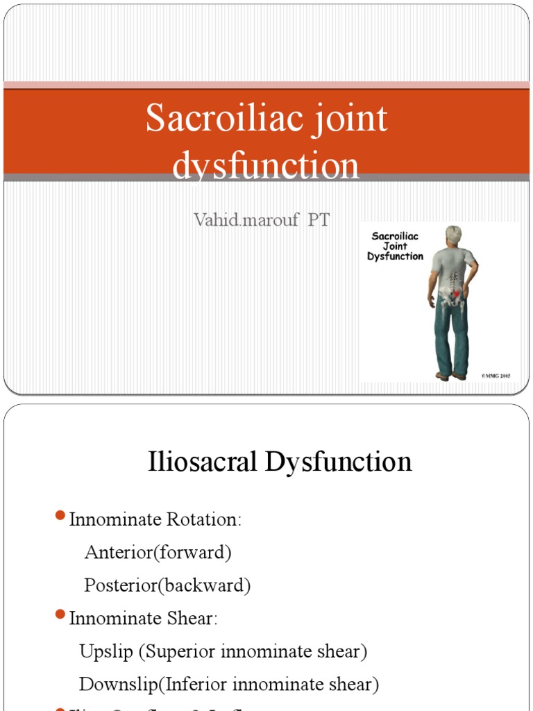 Sacroiliac Joint Dysfunction: Vahid - Marouf PT | PDF | Anatomical ...