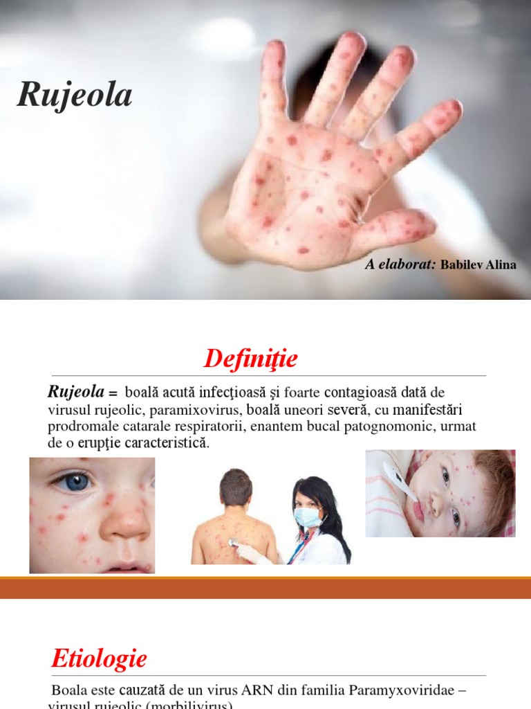Rujeola MD | PDF