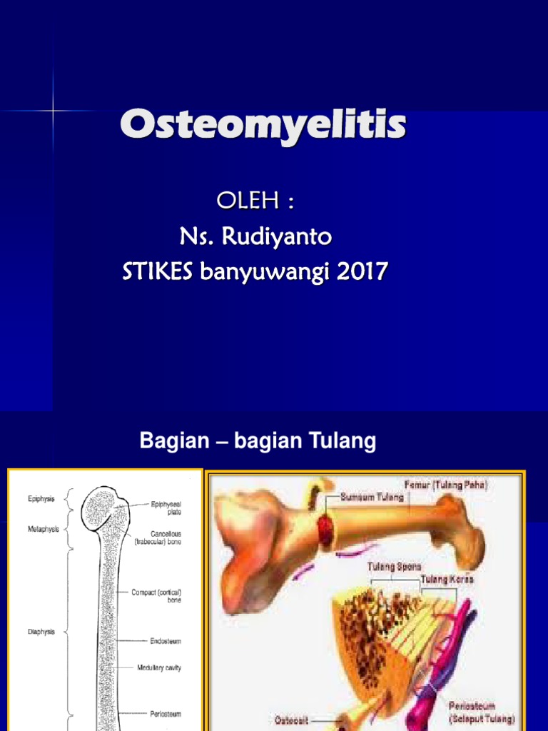 Osteomyelitis | PDF