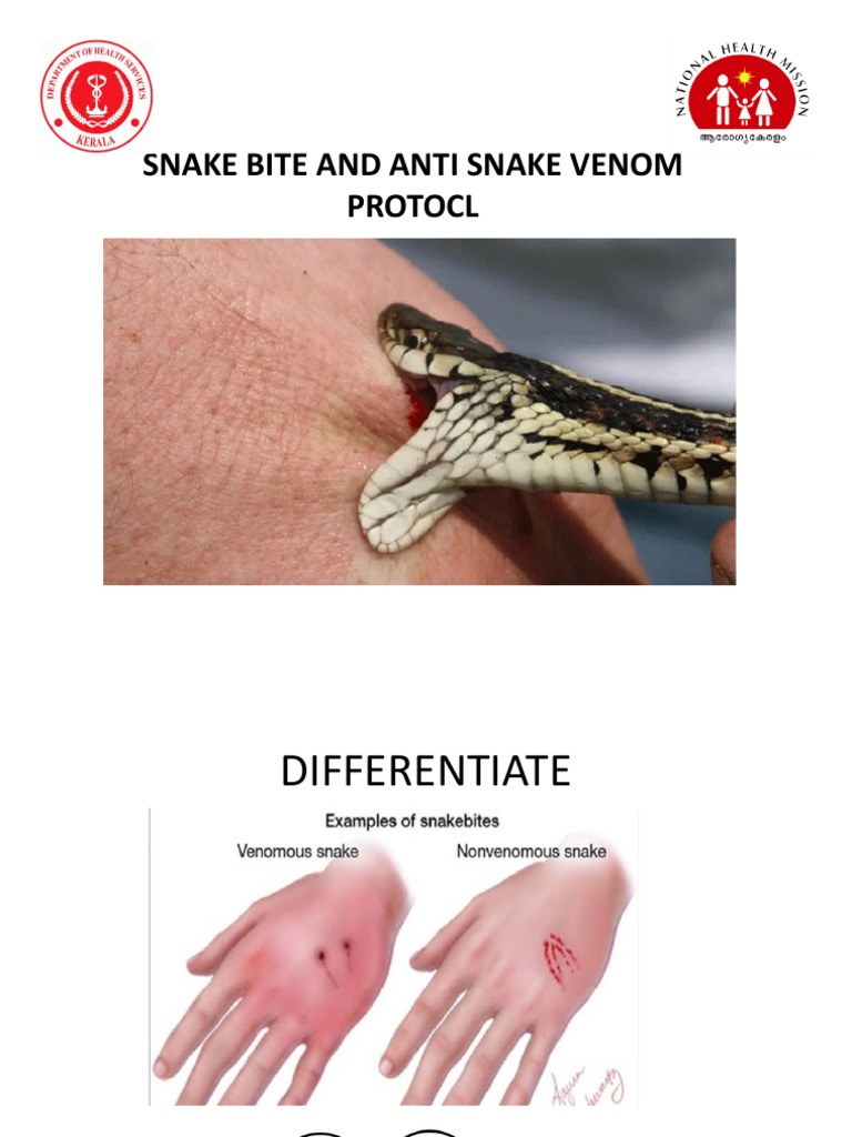 Snake Bite and Anti Snake Venam Protocol | PDF