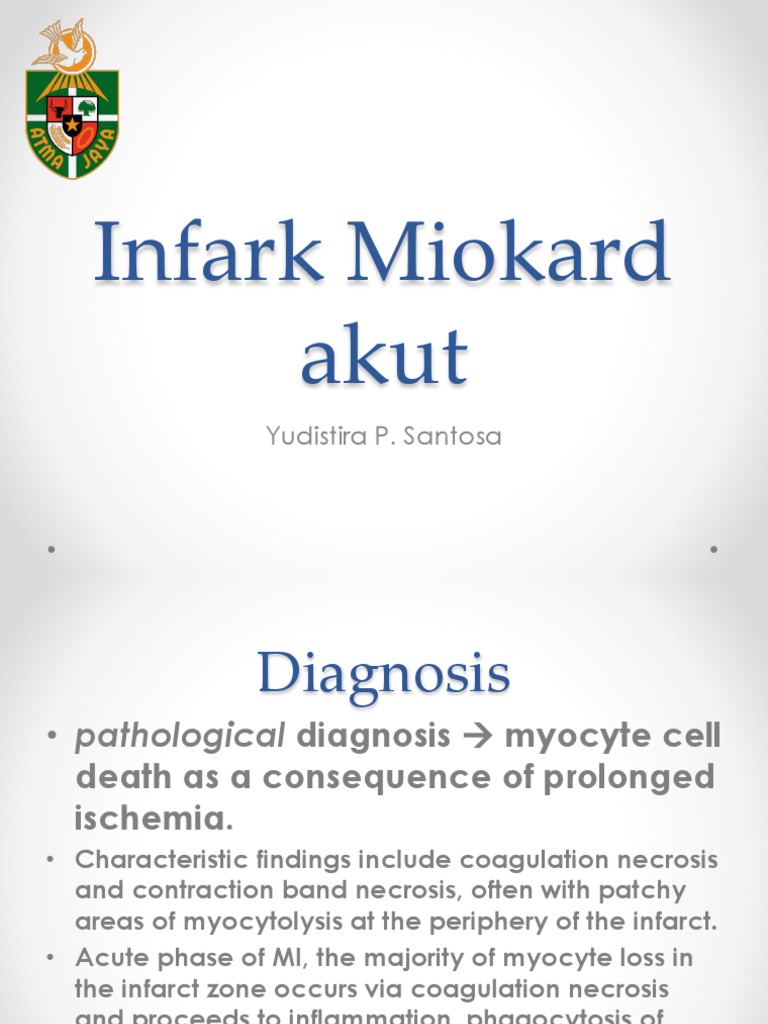 Acute Myocard Infarct | PDF | Myocardial Infarction | Electrocardiography