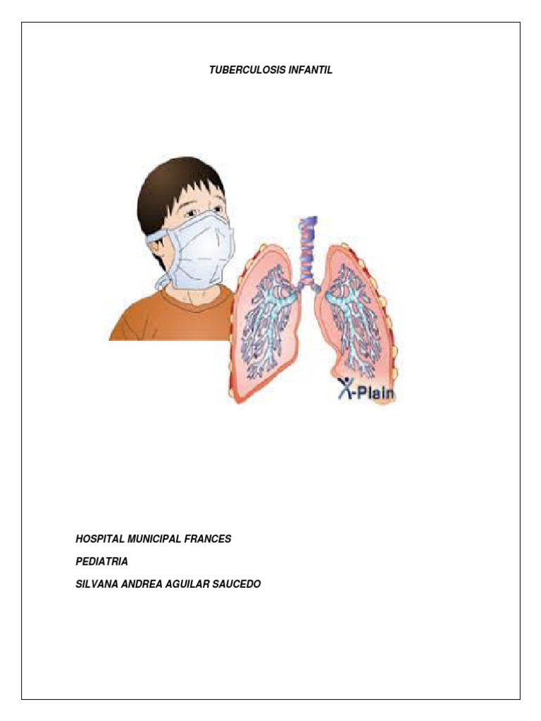Tuberculosis Infantil | PDF | Tuberculosis | Medicina CLINICA