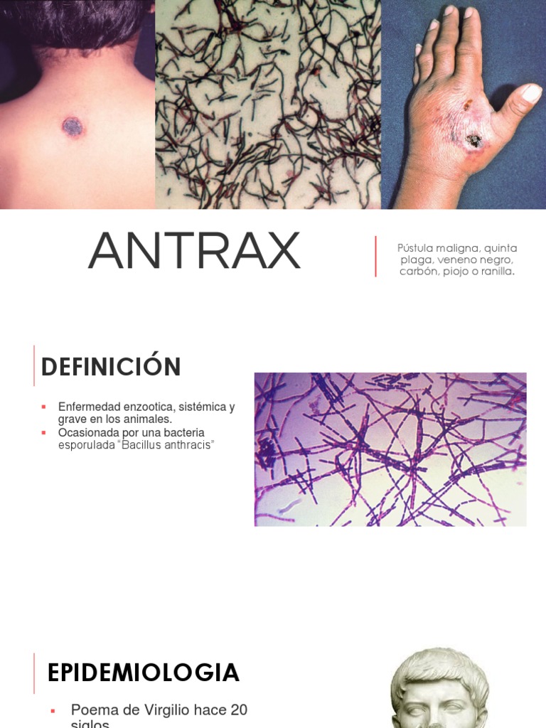 Antrax | PDF | Ántrax | Inmunología