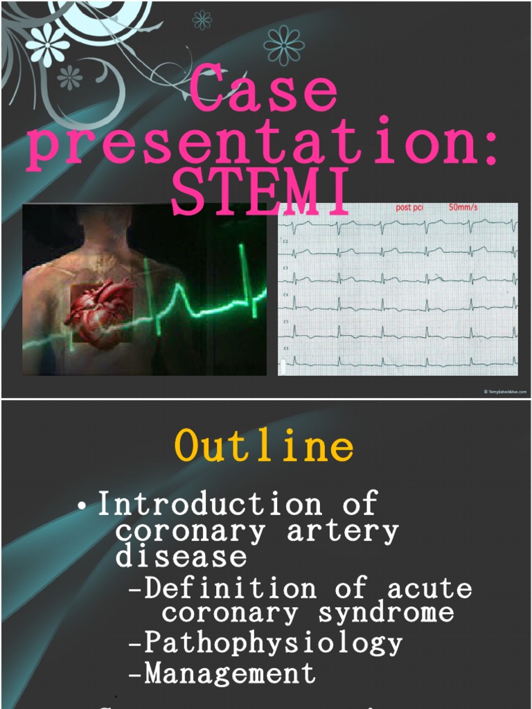 STEMI.ppt_แก้ไข_14_11_53