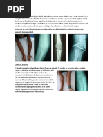 PALESTESIA Definicion y Exploración | PDF | Mano | Sistema ...