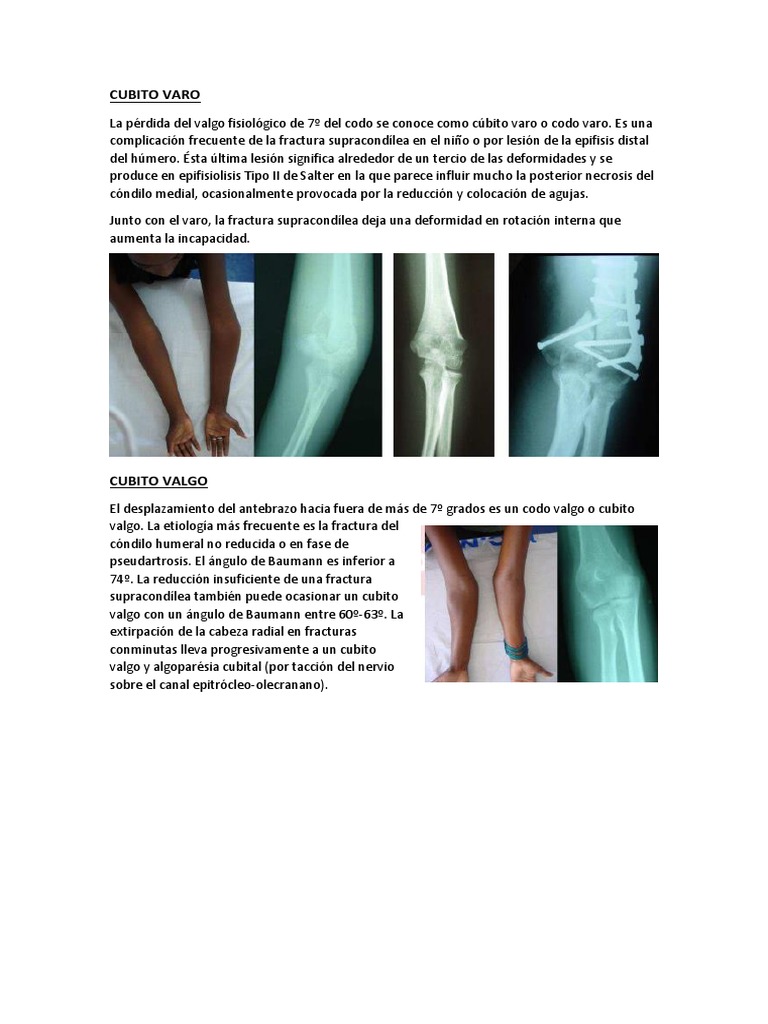 Varo y Valgo de Codo | PDF