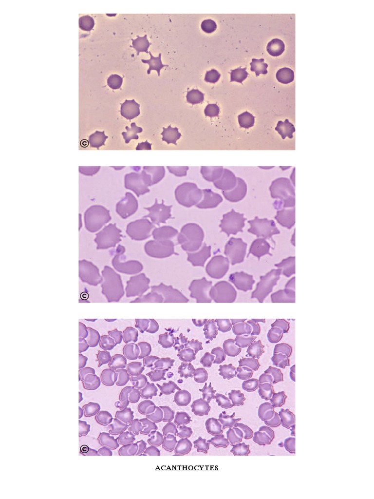 Atlas Hematologie | PDF