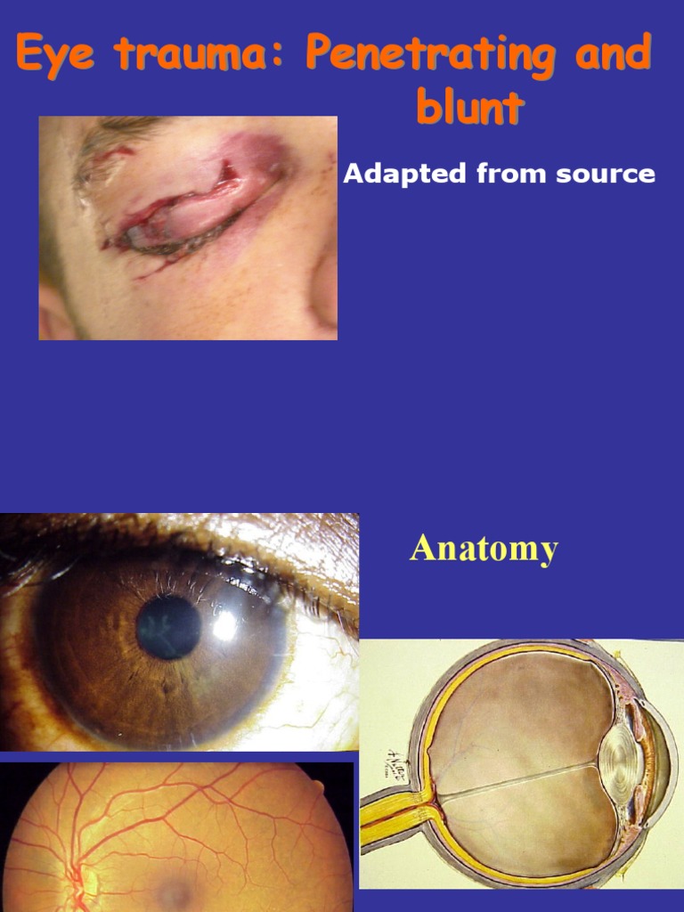 Eye Trauma: Penetrating and Blunt | Download Free PDF | Ophthalmology ...