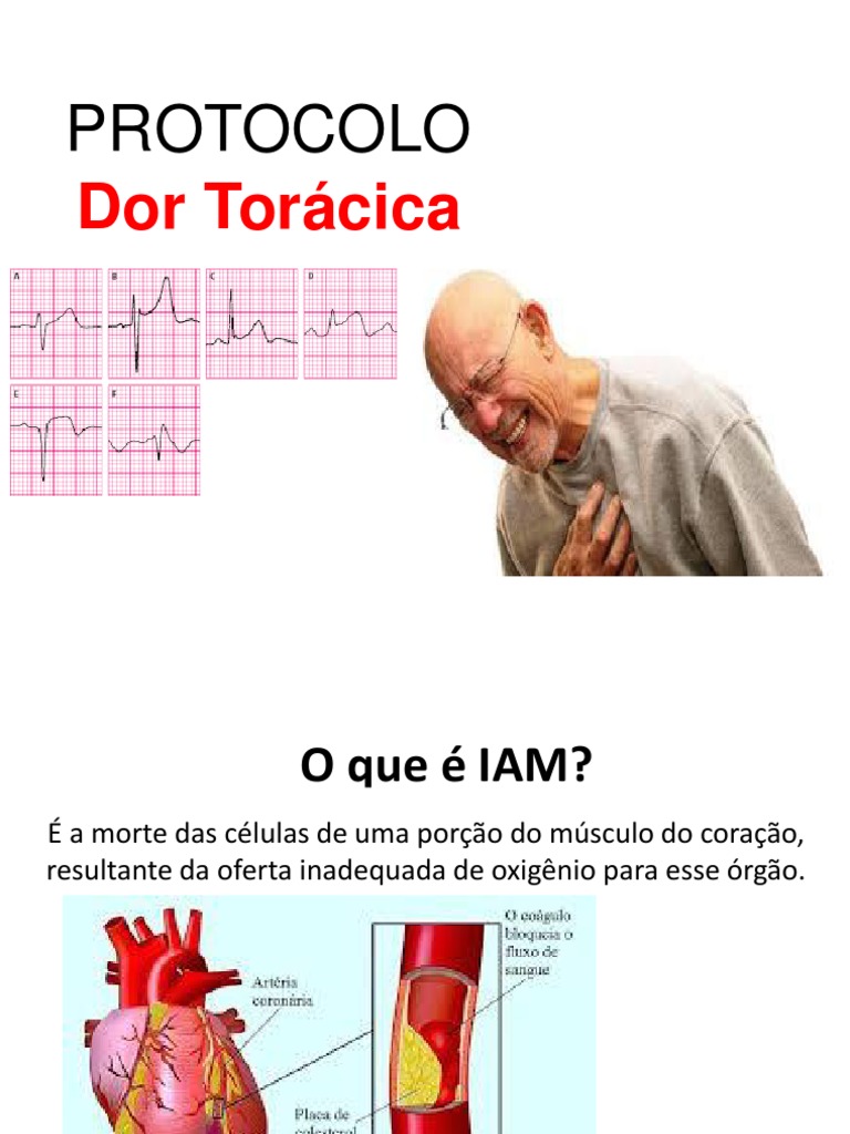 Protocolo de Iam | PDF | Fisiologia | Remédio