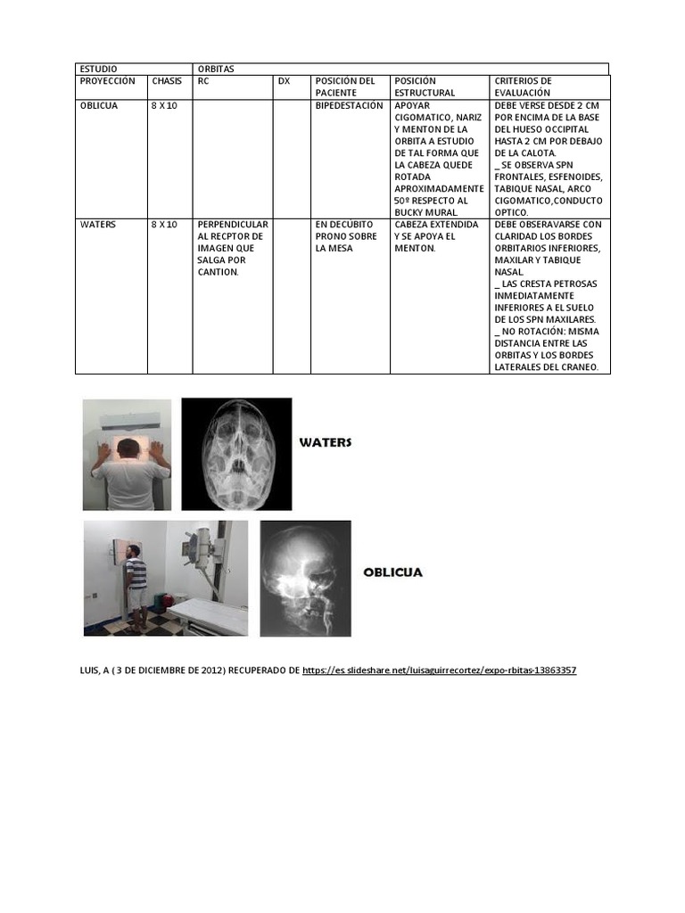 Protocolos RX Orbitas | Descargar gratis PDF | Rasgos faciales | Cara