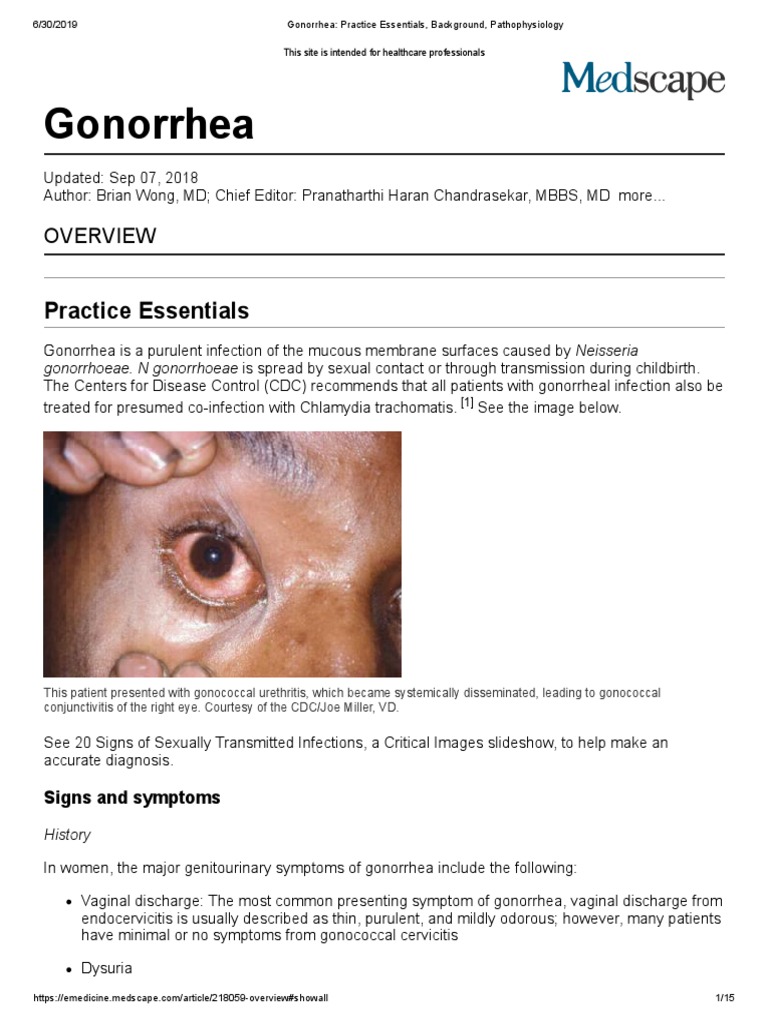 Gonorrhea - Practice Essentials, Background, Pathophysiology Sumber 13 ...
