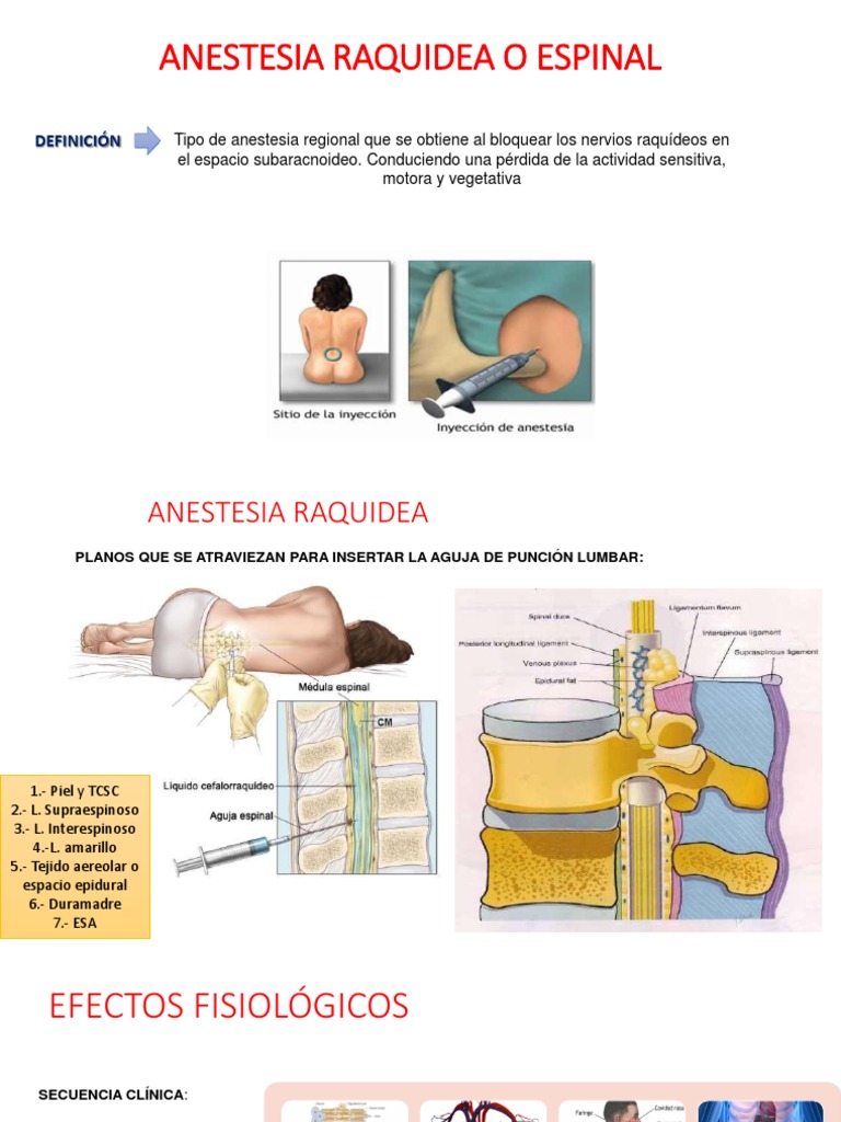 Anestesia Raquidea o Espinal | PDF | Fluido cerebroespinal ...