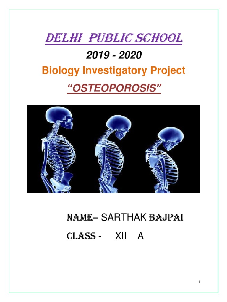 Class 12 Biology Project on Osteoporosis | PDF | Osteoporosis | Bone