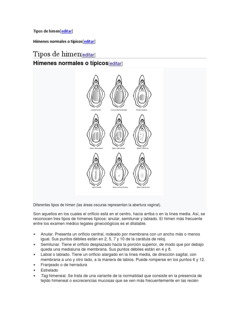 Tipos y características del himen femenino | PDF | Mutilación genital ...