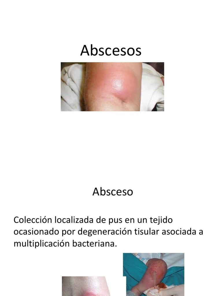 Fisiopatología Absceso | PDF | Rtt | Medicina CLINICA
