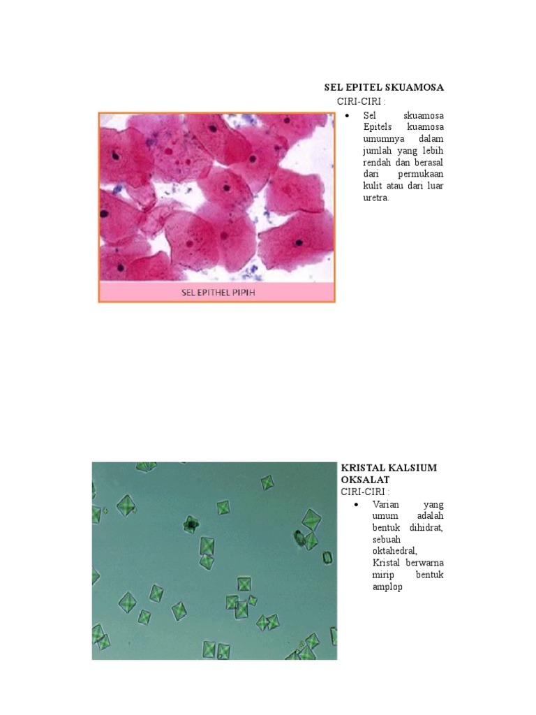 Atlas Sedimen Urin | PDF