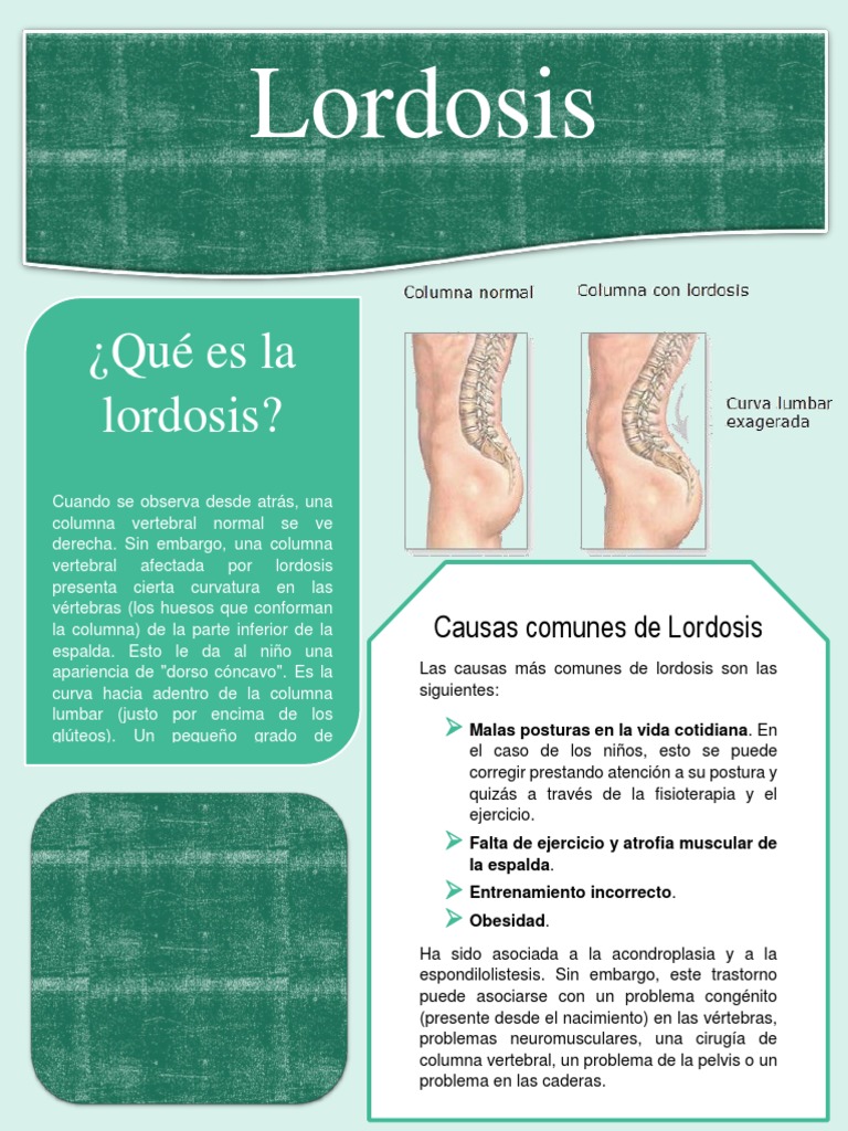 Lordosis Sin Nombre | PDF | La columna vertebral | Vértebra