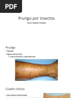 Prúrigo Por Insectos | PDF