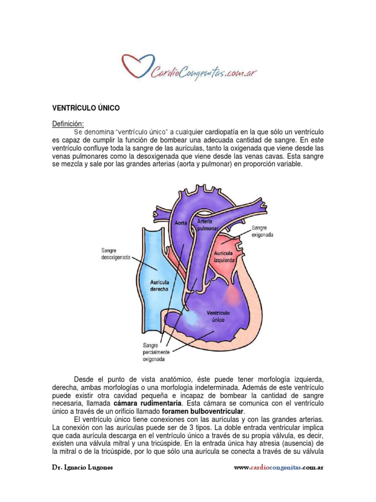 Ventriculo Unico | PDF | Ventrículo (corazón) | Atrio (corazón)