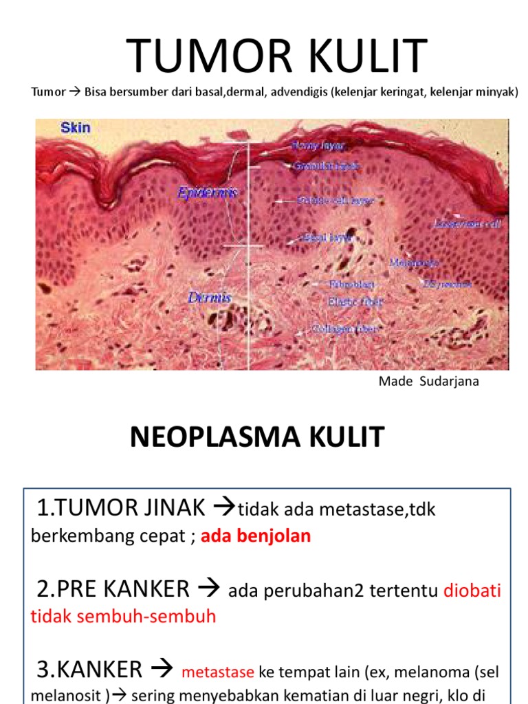 TUMOR JINAK DAN GANAS KULIT 232323 As | PDF