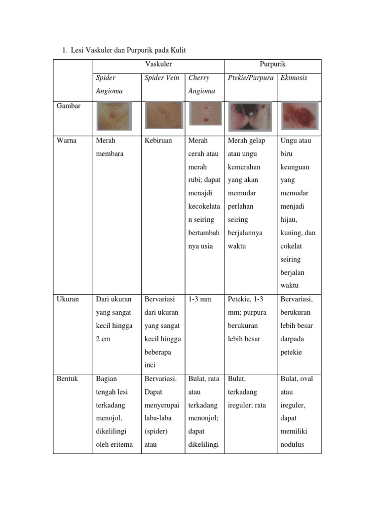 Lesi Vaskuler Dan Purpurik Pada Kulit | PDF