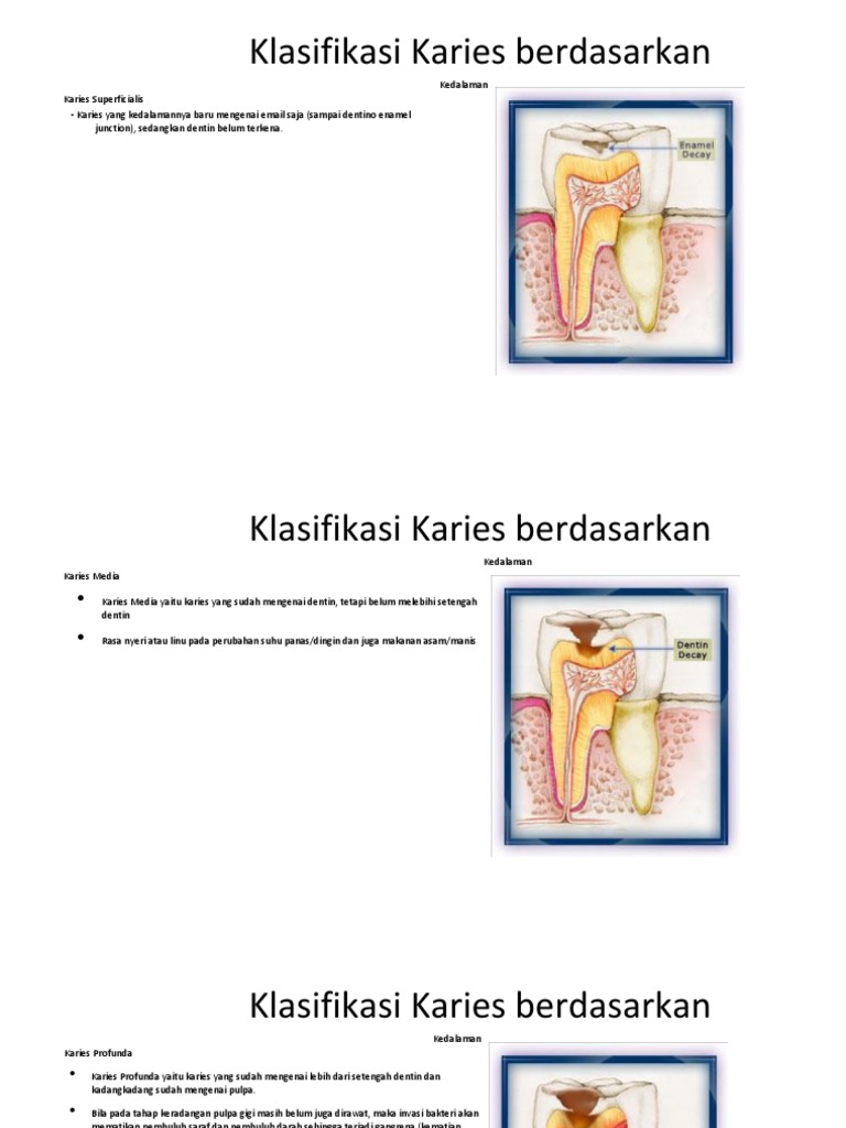 Klasifikasi Karies | PDF