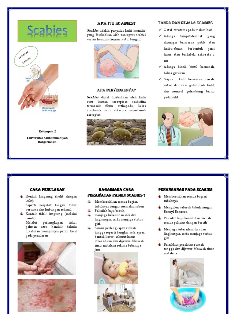 Apa itu Scabies? Gejala, Penyebab, Cara Penularan dan Penanganannya | PDF