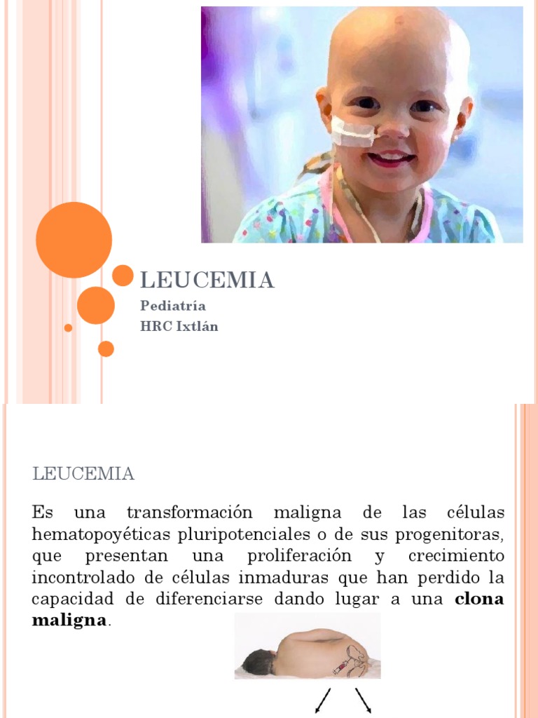 LEUCEMIA | PDF | Leucemia | Sangre