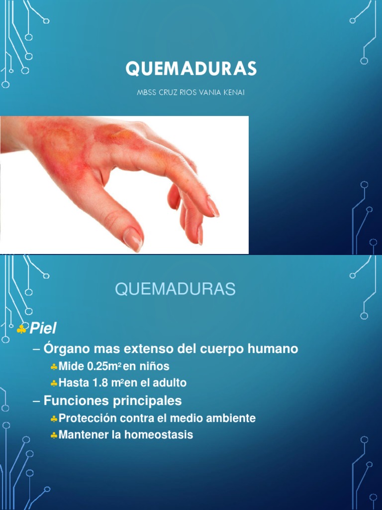 Quemados | PDF | Quemar | Piel
