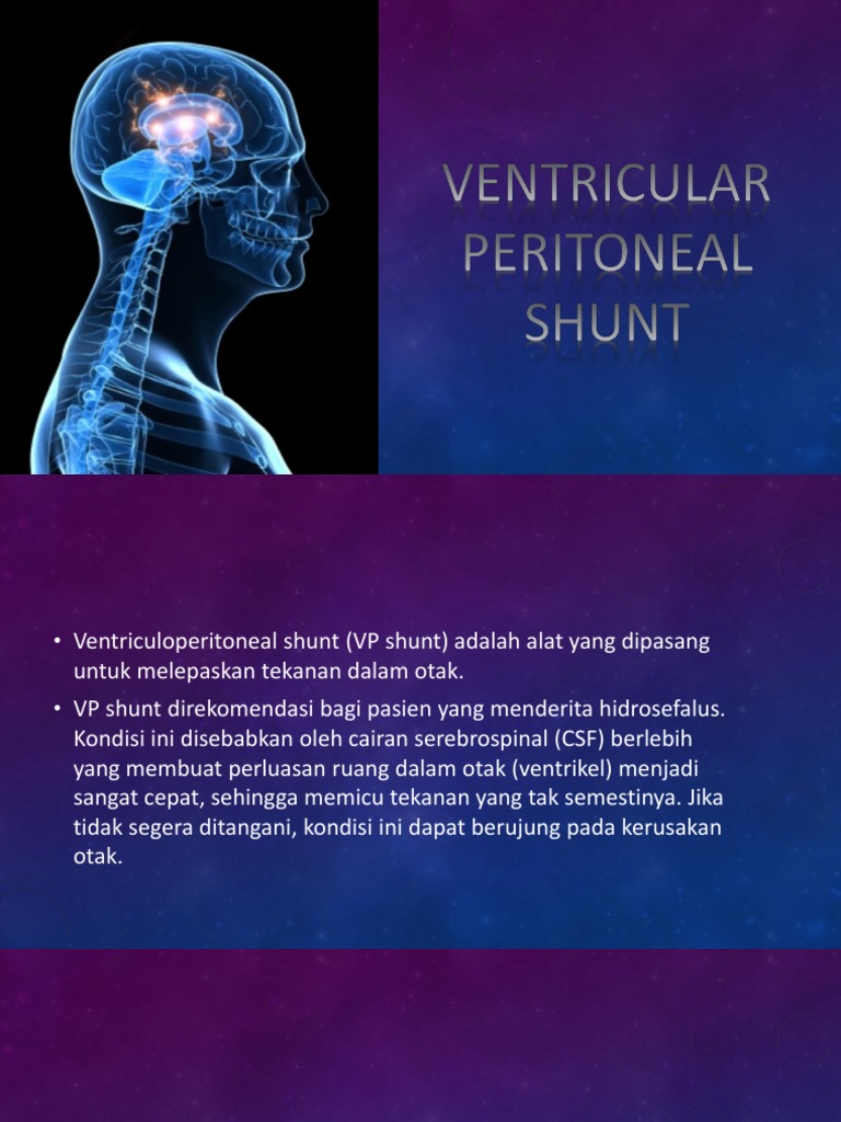 Presentation VP Shunt | PDF