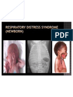 Appendix D - Silverman Anderson Score | PDF | Infants | Thorax