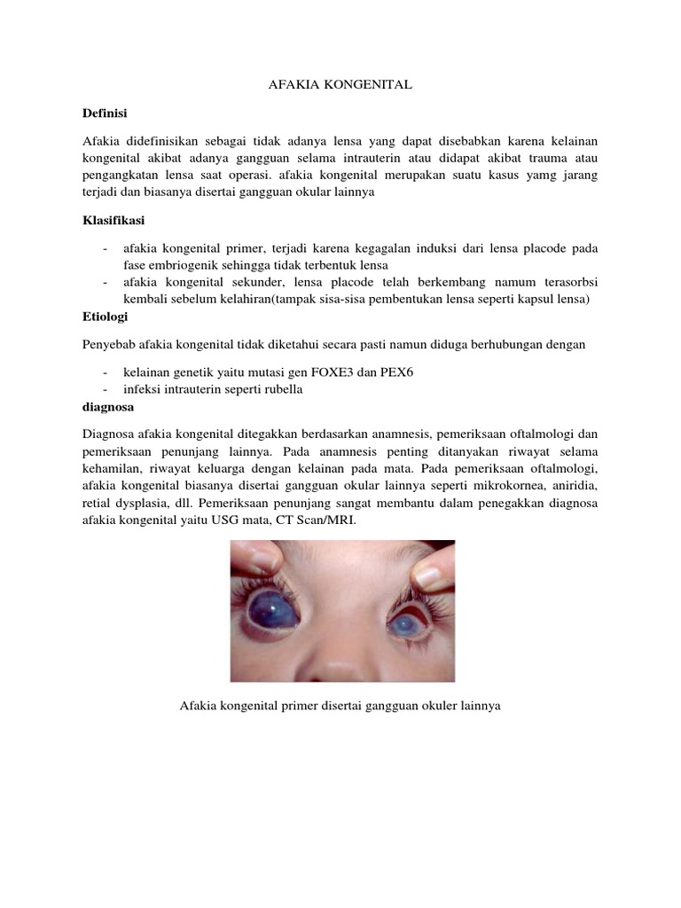 Afakia Kongenital: Definisi dan Penanganan | PDF | Kesehatan Holistik