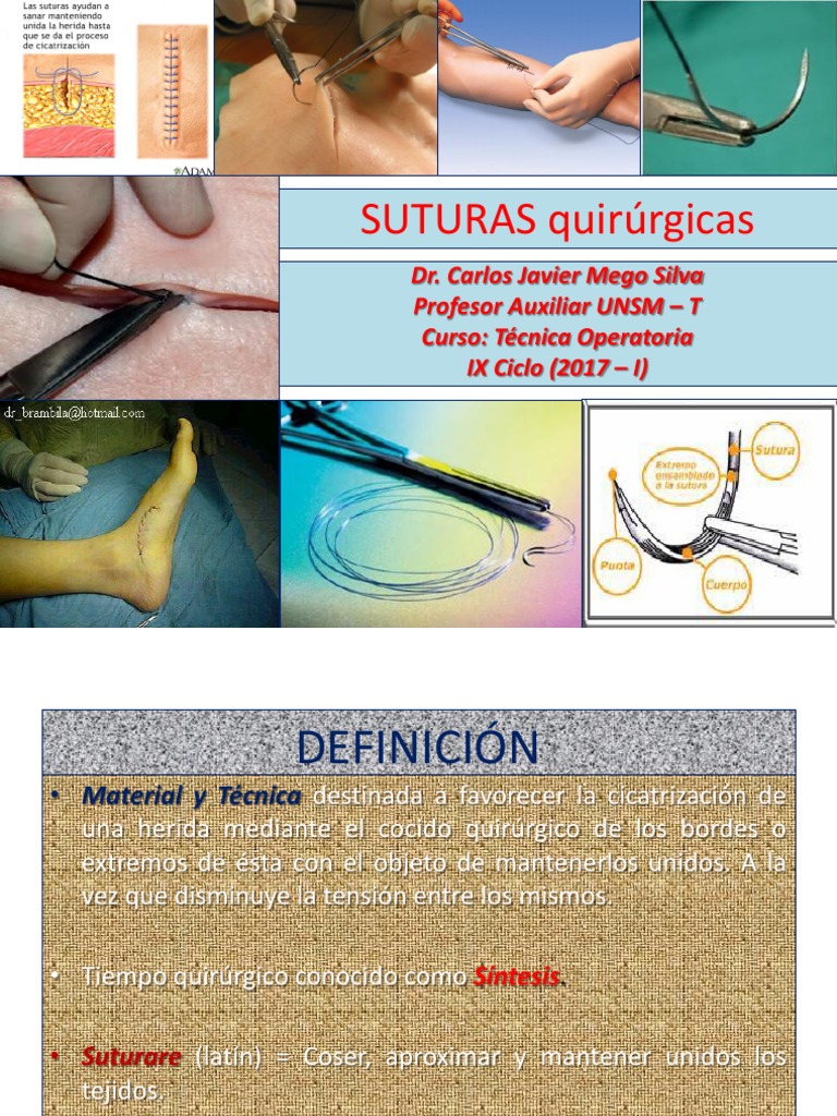 Suturas Exposición 1 | PDF | Sutura Quirúrgica | Seda