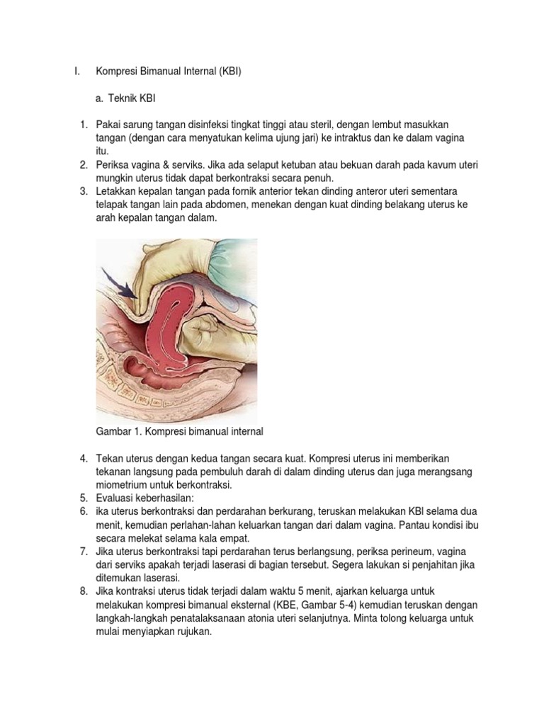 Teknik Kompresi Bimanual Uterus | PDF