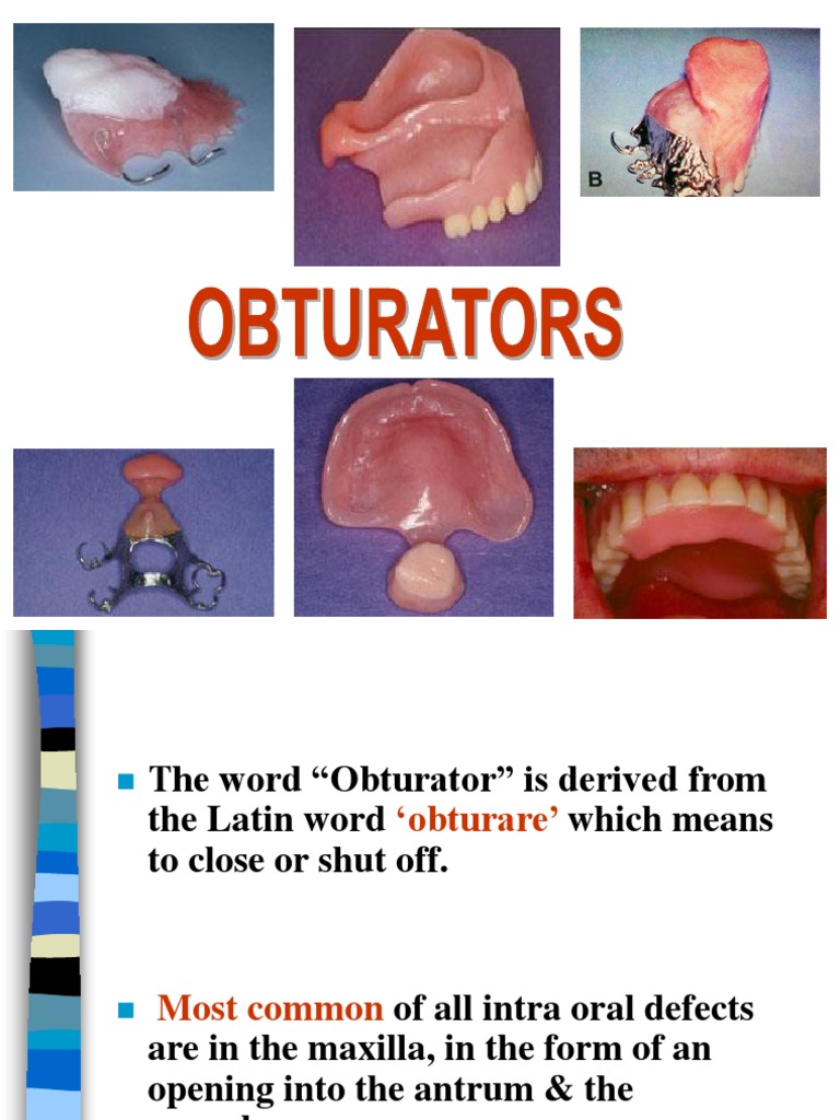 Obturators | PDF | Dentures | Prosthesis