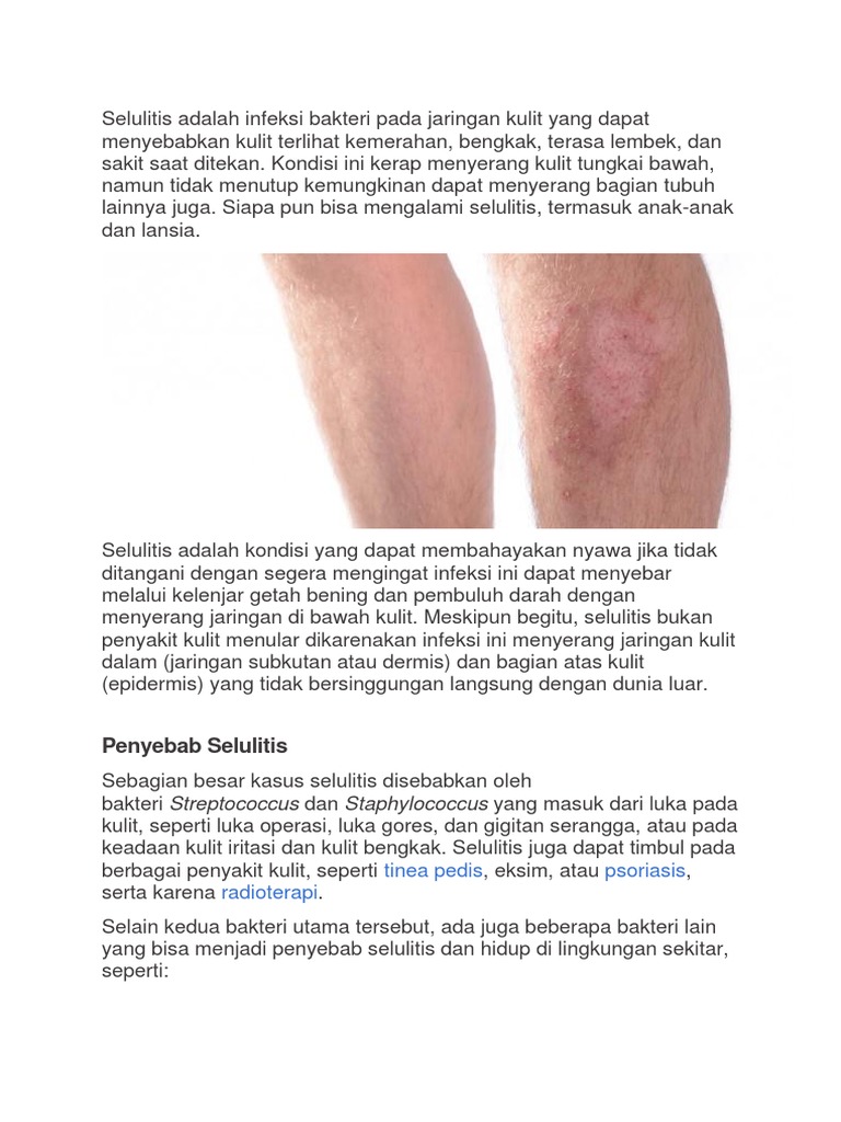 Panduan Selulitis: Gejala dan Pencegahan | PDF