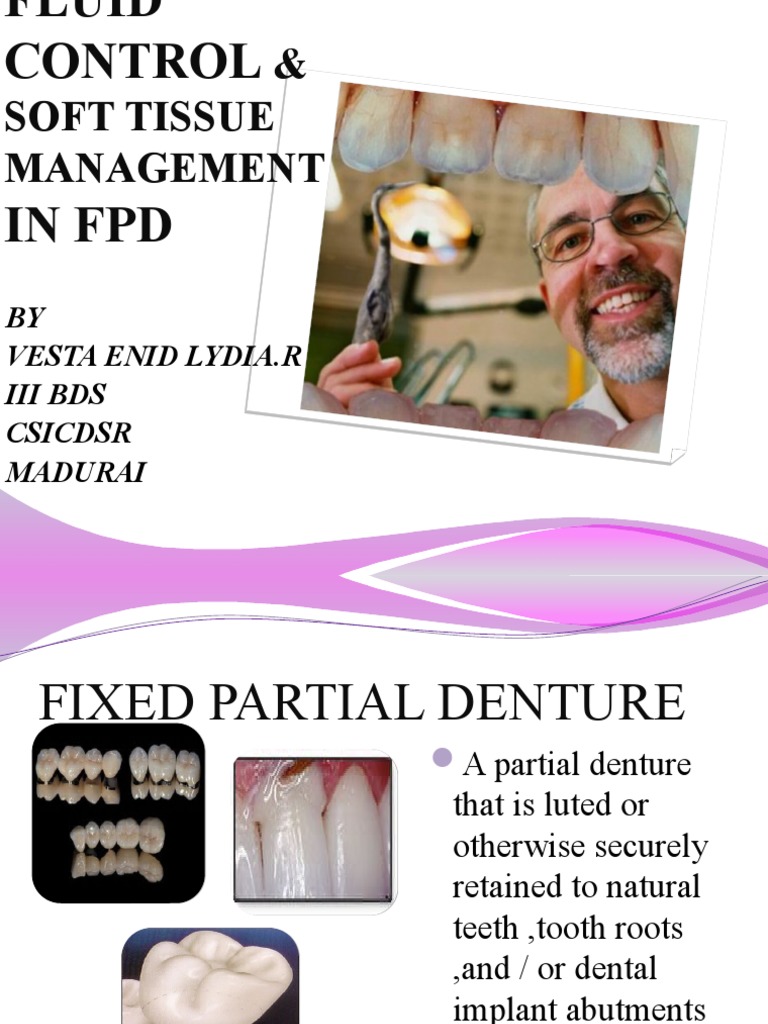 Fluid Control & Soft Tissue Management in FPD | PDF | Nature | Dentures