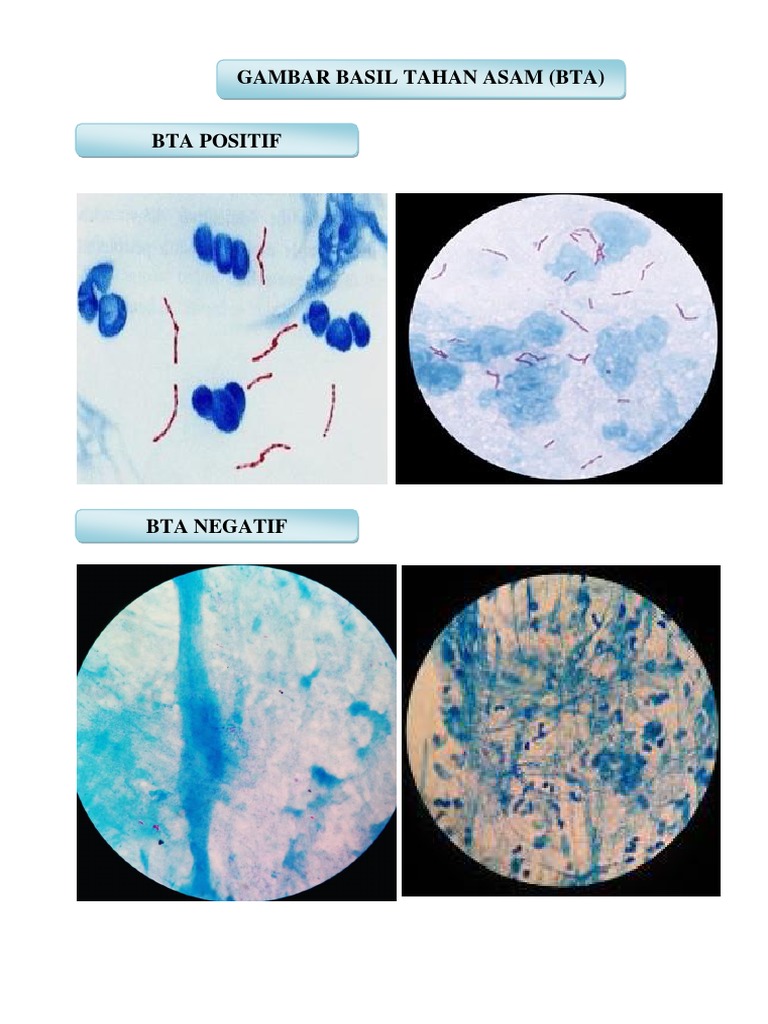 Gambar Bta Pdf