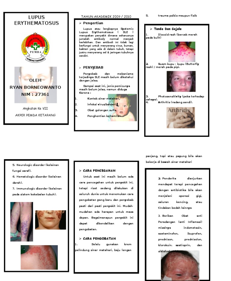 Leaflet Lupus PDF | PDF
