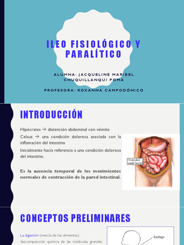 Análisis del íleo fisiológico y paralítico: causas, síntomas y ...