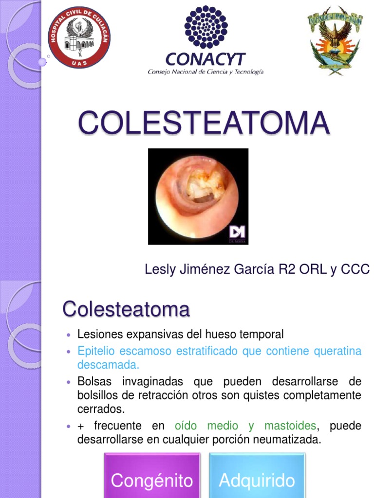 Colesteatoma 170105084017 PDF | PDF | Epitelio | Oído