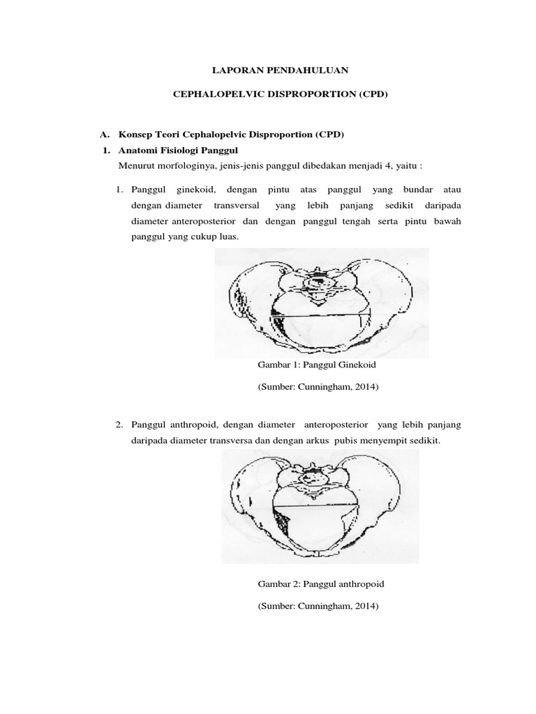 Memahami Cephalopelvic Disproportion (CPD) | PDF