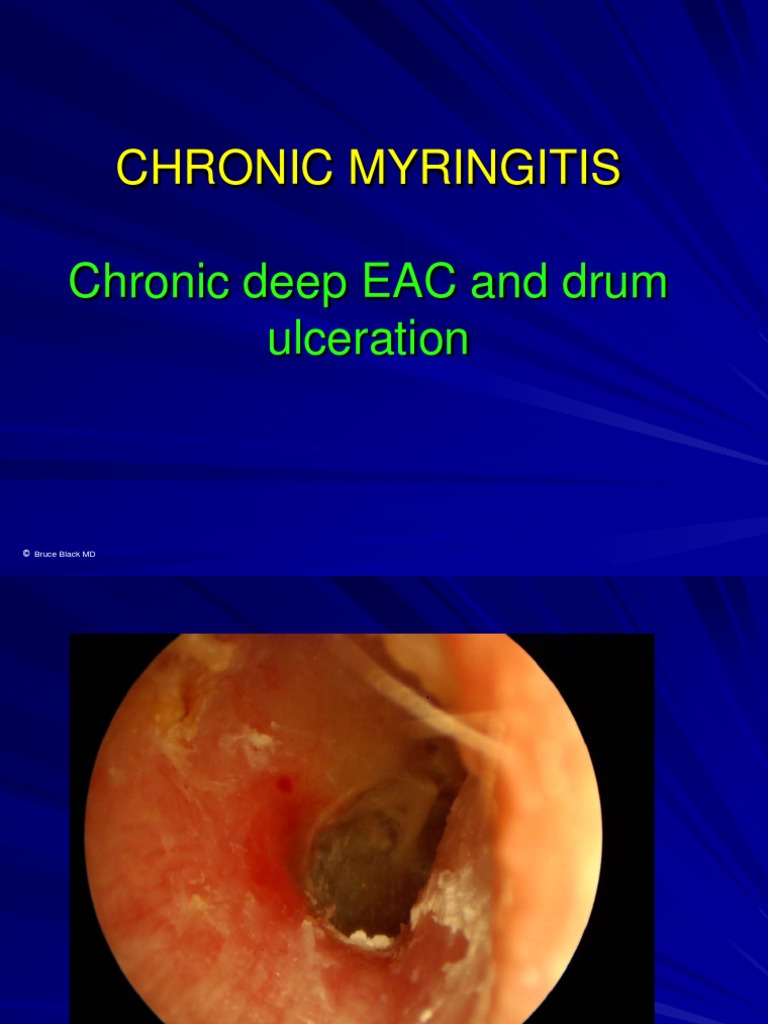 3 Chronic Myringitis | PDF | Otology | Human Head And Neck