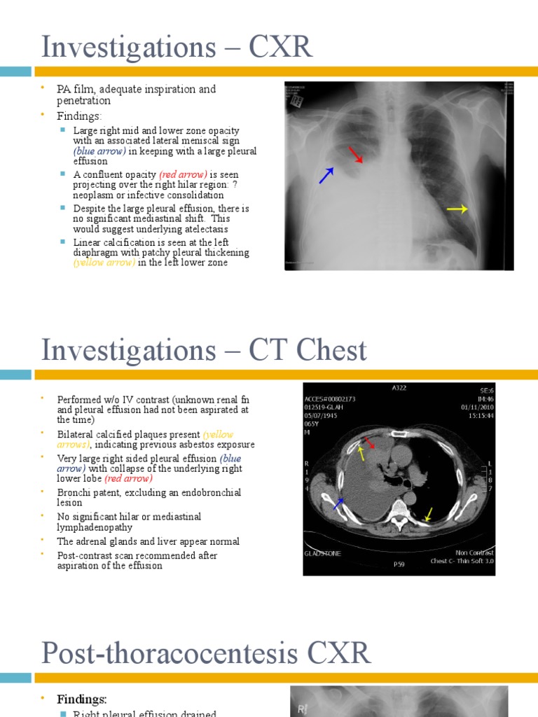 Investigations - CXR: PA Film, Adequate Inspiration and Penetration ...