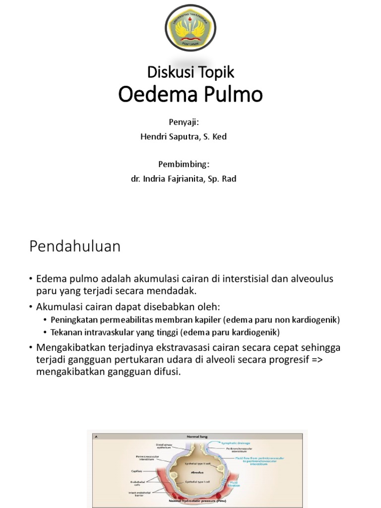 DT Edema Pulmo | PDF