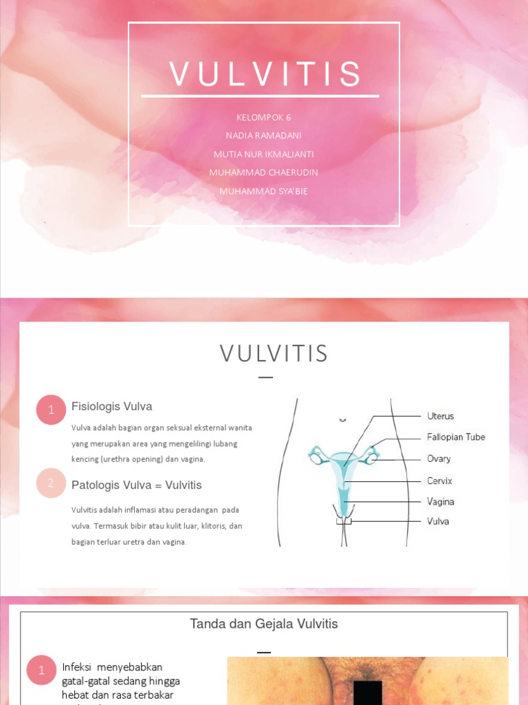 Kelompok 6 Vulvitis | PDF